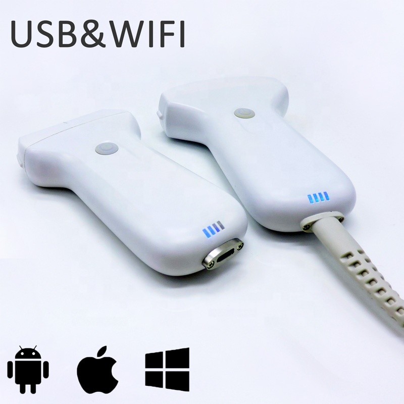 Color Doppler Wireless Ultrasound Scanner